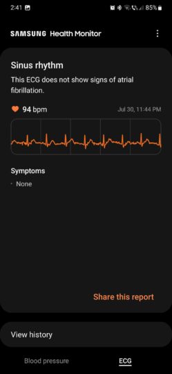 Samsung Health week: ECG and blood pressure monitoring - SamMobile