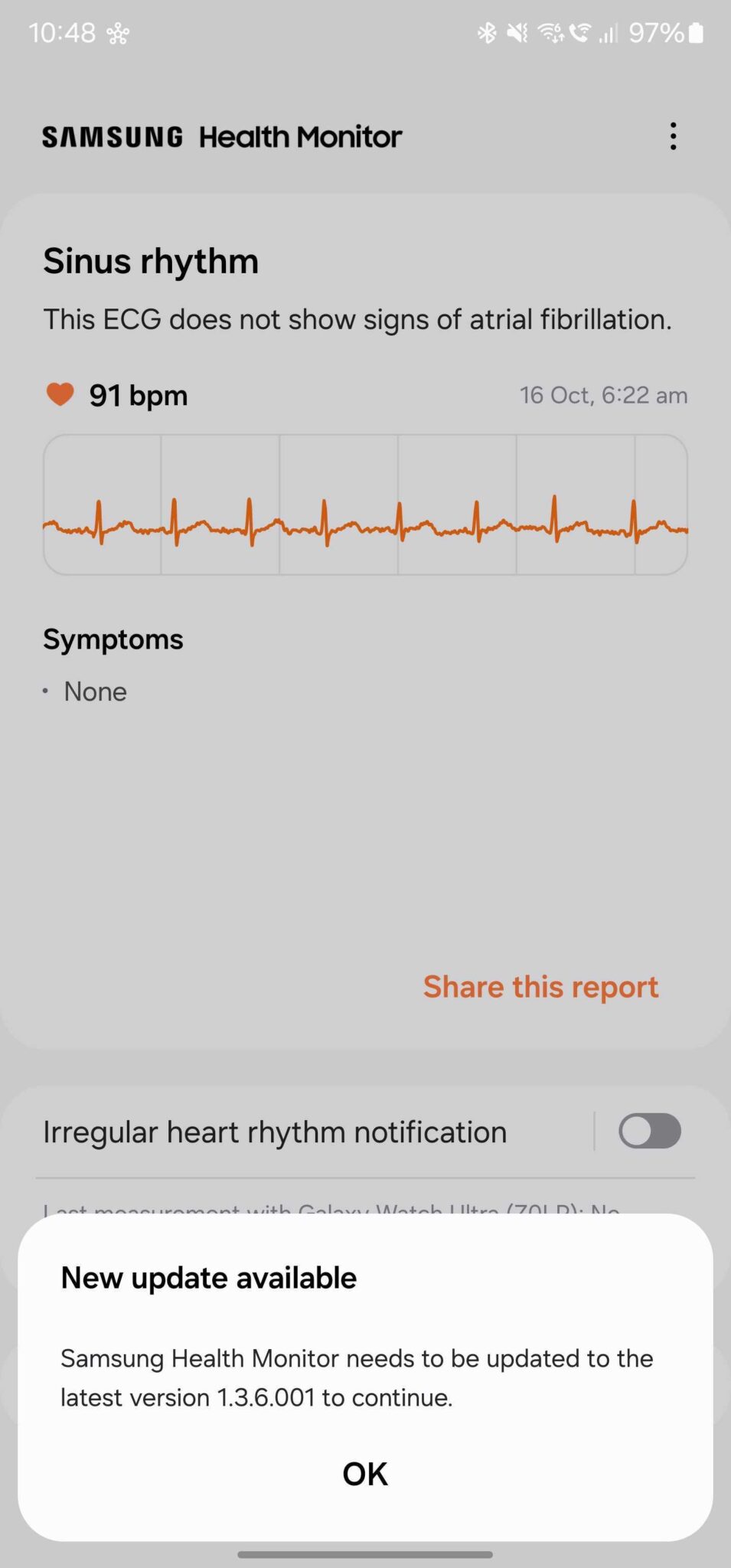 Samsung Health Monitor won't work on phones with Android 11 (or below ...